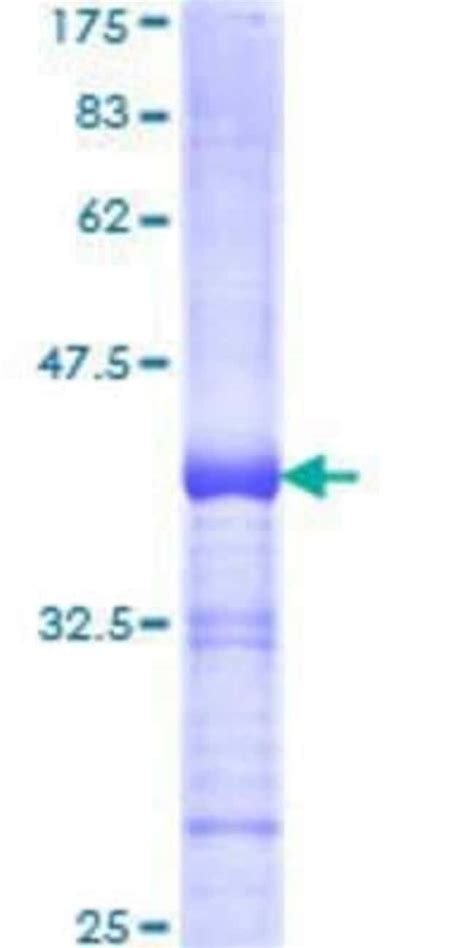 Novus Biologicals Recombinant Human Hnrnp M Gst N Term Protein 10 μg