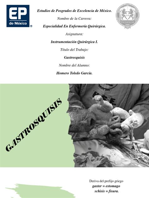 Gastrosquisis Pdf