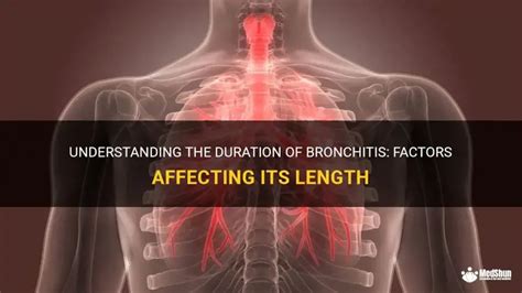 Understanding The Duration Of Bronchitis Factors Affecting Its Length