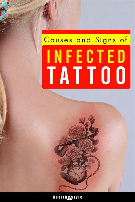 Causes And Signs Of Infected Tattoo How To Treat Infected Tattoo