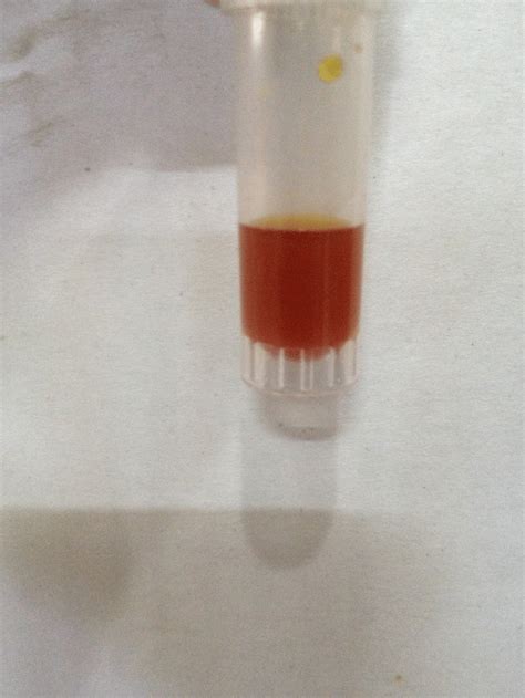 Can A Colored Compound Not Have A Lambda Max In Visible Range Of Light ResearchGate