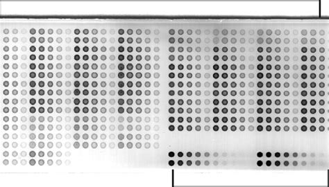 Example Of A Reverse Phase Protein Microarray Samples Are Spotted In A
