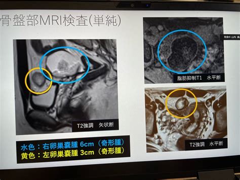 定例の医局会 生殖医療専門医・内視鏡手術技術認定医 田中雄大のブログ