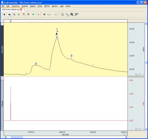 EDA Electrodermal Activity Consumer Neuroscience Skin Conductance Response EDA Research