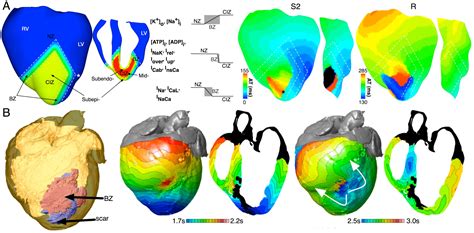 Whole Heart Modeling Applications To Cardiac Electrophysiology And