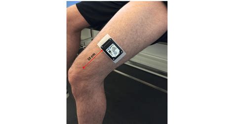 Moxy Monitor Placement Download Scientific Diagram