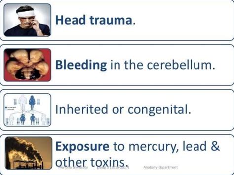 Cerebellar Dysfunction Ppt Pptx