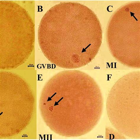 Nuclear Maturation Stage Of Oocytes In Various L Carnitine