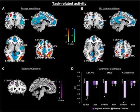 Task Related Neural Response The Task Was A Modified Attention Network Download Scientific
