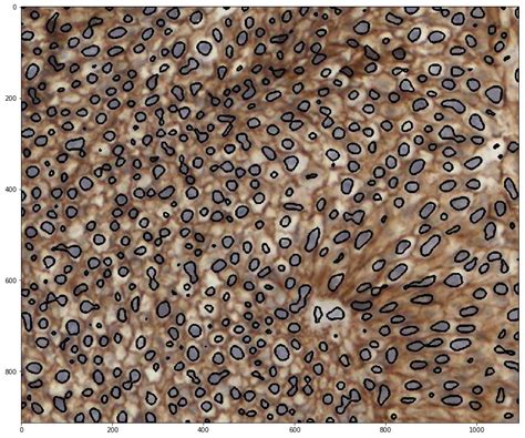 Hsv Color Model Segmentation And Classification By Javier Abellán