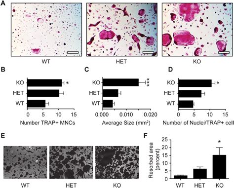 Osteoclast Cultures From Hdac7 Wt Het And Ko Mice Trap Staining A Download Scientific