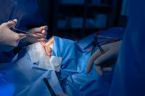 안검 성형술 눈꺼풀의 결함 기형 및 기형을 교정하기 위한 성형 수술 그리고 얼굴의 눈 영역을 미학적으로 수정하기 위해 진료소에서 남자에 대한 스톡 사진 및 기타 이미지