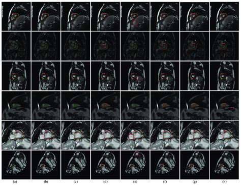 Detection Examples By Proposed Methods And Compared Detection Methods