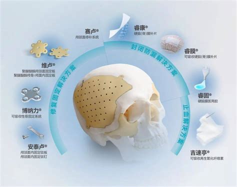 Cns 迈普医学携神经外科修复关颅解决方案亮相 艾邦医用高分子网