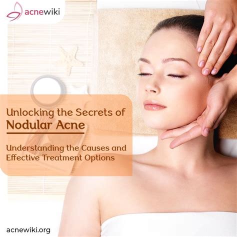 Nodular Acne Artofit