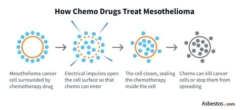 Chemotherapy For Mesothelioma Types And Side Effects