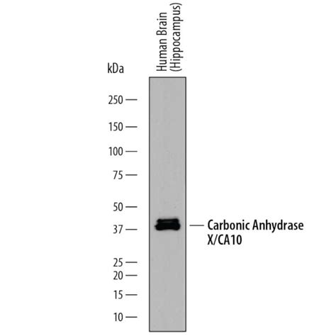 Carbonic Anhydrase X Monoclonal Antibody 862319 Ma5 61116