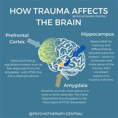 Frontal Lobe Function Location And Structure Artofit