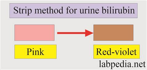 Urine Bilirubin Bilirubinuria Labpedia Net