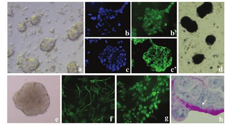 Mouse Embryonic Stem Cells And Their Derived Embryoid Bodies Morfology