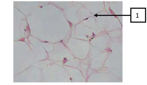Epithelial And Connective Tissue Flashcards Quizlet