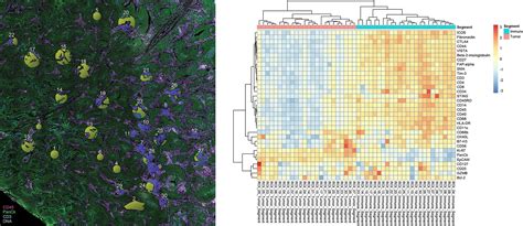 Geomx® Immuno Oncology Protein Panels Nanostring