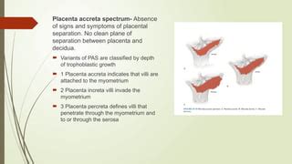 Retained Placenta Management And Pptx Pptx