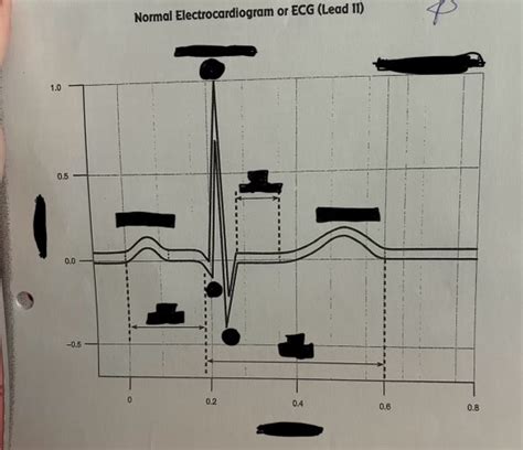 Normal Electrocardiogram Or ECG Diagram Quizlet