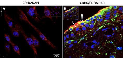 Unique Pattern Of Cadherin 6 Localization In Fibroblast Like Synoviocytes Acr Meeting Abstracts