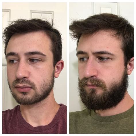 List 92 Pictures Weekly Beard Growth Pictures By Week Latest