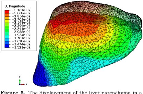 Figure 5 From Developing A Deformable Model Of Liver Tumor During