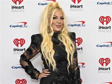 Tori Spelling Explained How She Got An Eye Ulcer And Honestly It