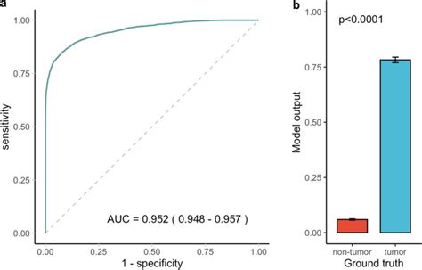 Deep Learning Predicts Postsurgical Recurrence Of Hepatocellular Carcinoma From Digital