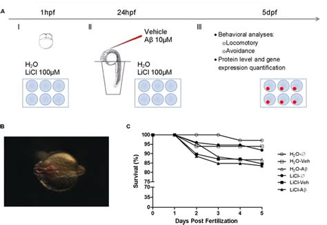 Injection Intraventriculaire