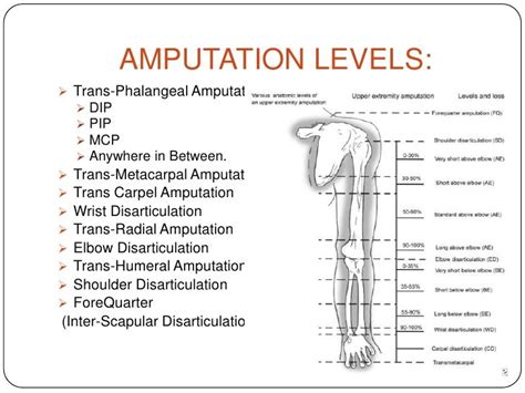 Upper Limb Functional Prosthesis