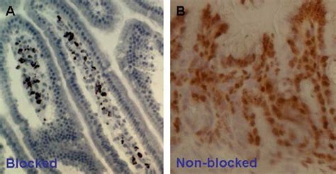 Comparing Ihc Images With Or Without Blocking Intestinal Segments Were Download Scientific