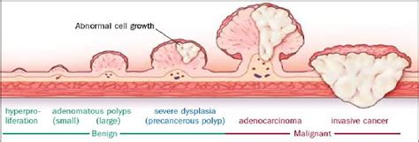 Figure 1 From The Importance Of Data Classification Using Machine Learning Methods In Microarray