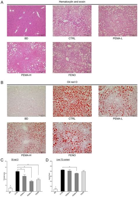 Pemafibrate A Novel Selective Peroxisome Proliferator Activated Receptor Alpha Modulator