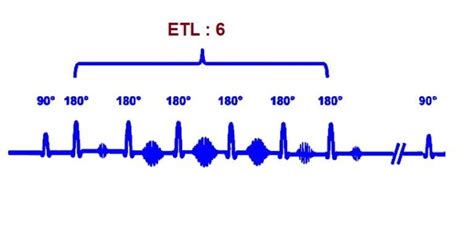 Etl In Mri Mri Echo Train Length Etl