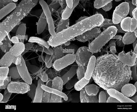 E Coli Bacteria Scanning Electron Micrograph Sem Of Escherichia Coli E Coli Bacteria Rod