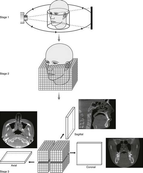 Cone Beam Ct Image Reconstruction The Best Picture Of Beam