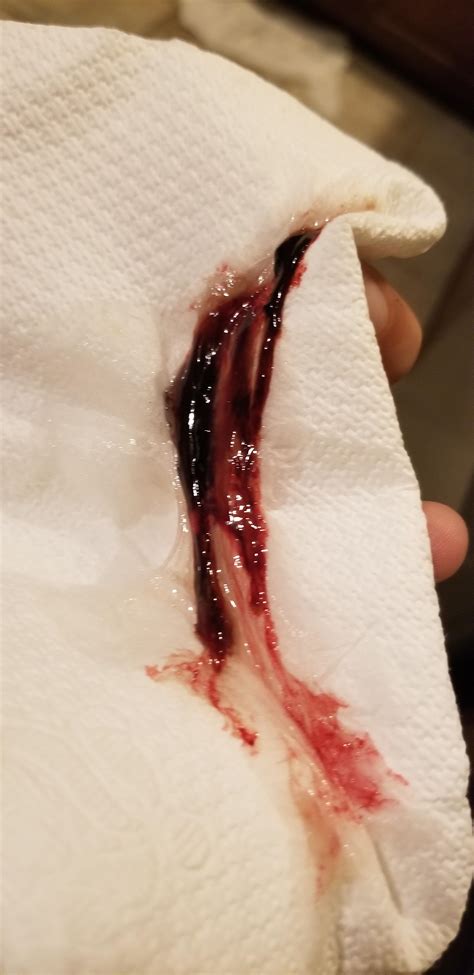 My 9 Yr Old Babe And Her 2nd Neti Pot Experience Yielded This Magnificent Gem She Says