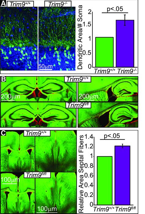 Deletion Of Trim9 In Vivo Increases Dendritic Arborization And Download Scientific Diagram