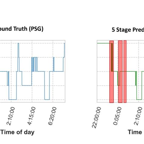 Pdf Making Sense Of Sleep Multimodal Sleep Stage Classification In A Large Diverse