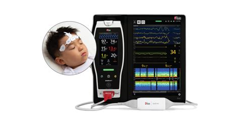 Masimo Announces Ce Marking Of Pediatric Indication For Next Generation Sedline® Brain Function