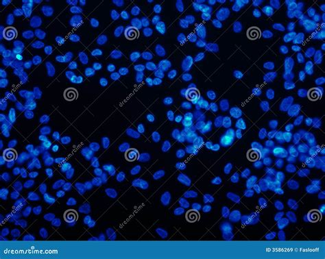 Cells Of A Human Thyroid Gland With Swelling Under A Microscope Stock