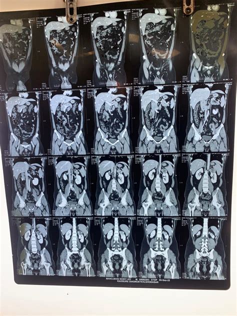 Dr Rohan Patel Ananta Urology And Robotics Clinic