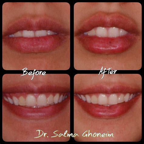 dr salma ghoneim ghoneim salma twitter