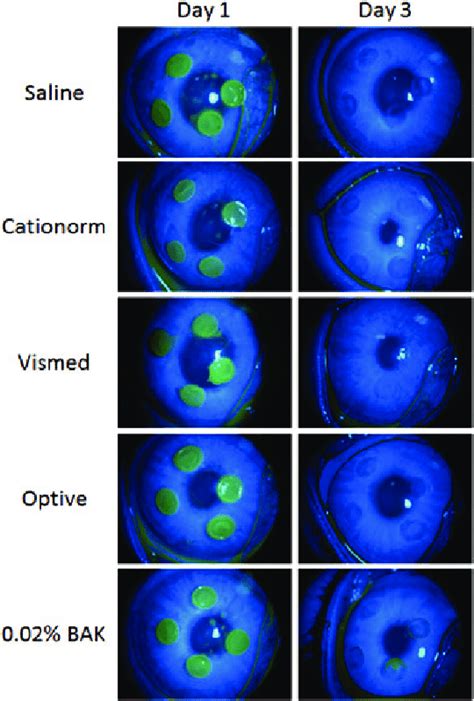 Corneal Staining Patterns