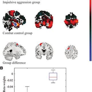 Group Differences In Functional Connectivity Between The Right ACC And Download Scientific